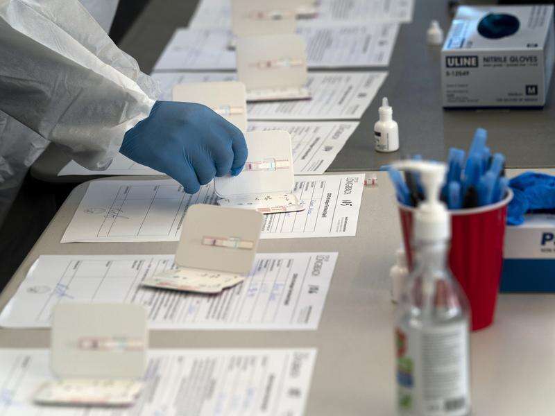 Victoria hotline for positive test results | Country News