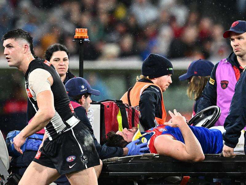 Concussion injuries remain key issue for AFL, AFLW | Country News