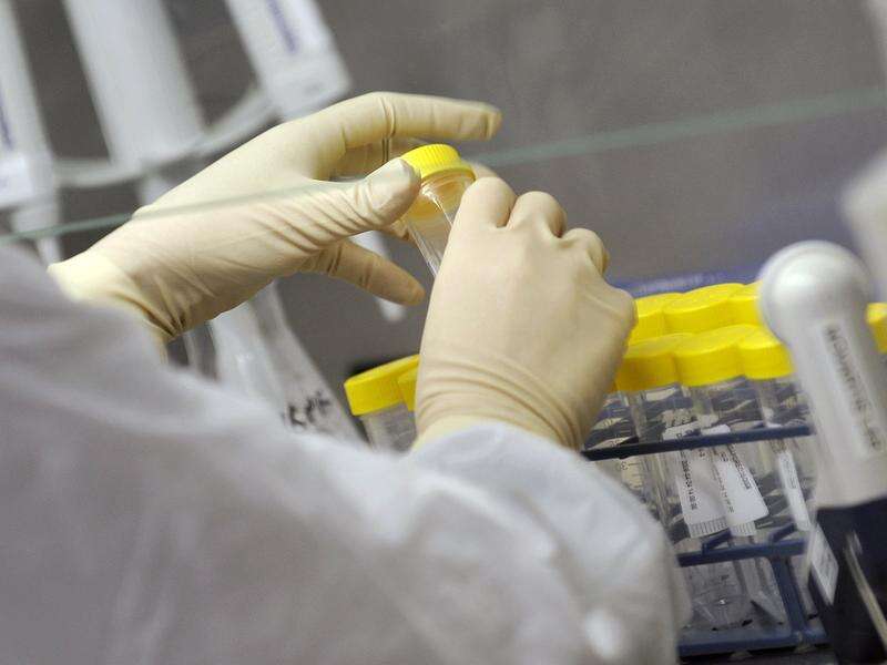 Blood cancer drug could replace lifelong HIV medication | Kyabram Free ...